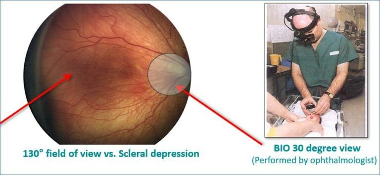 Optimizing the ROP screening process for neonates - Natus Sensory